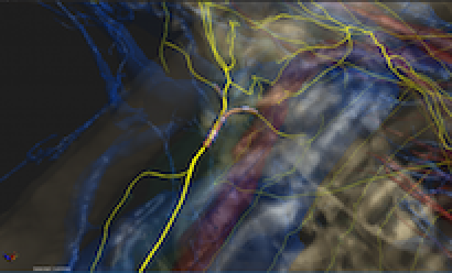 Sim4Life & S4L » IT'IS Foundation